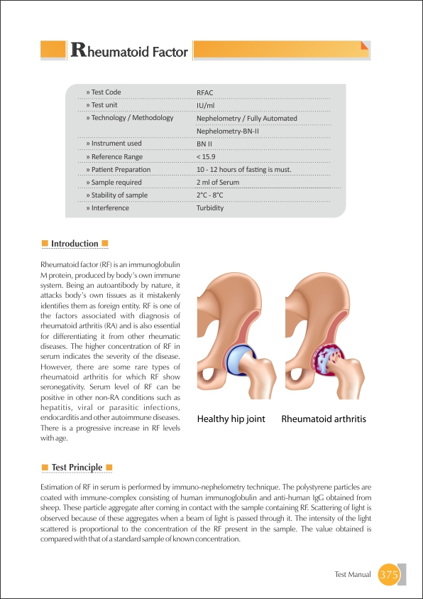 Rheumatoid Factor (RF) Test Price Rs.666 | Thyrocare